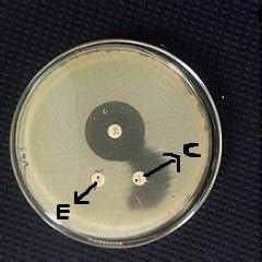 D Test Demonstrating A Blunting Of Zone Of Inhibition Around The Download Scientific Diagram