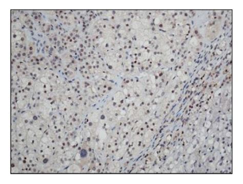 Immunohistochemical Staining Of Chek2 Protein A Staining For Normal Download Scientific