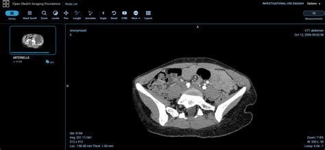 Draw Edit Save Contour Issue Ohif Viewers Github