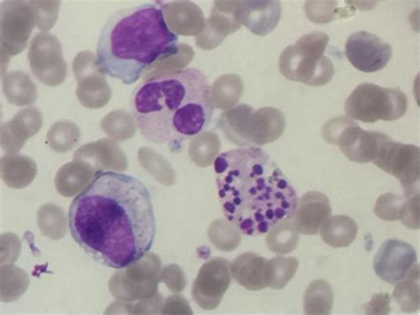 53张细胞形态，来看看认多少？ 学术交流 检验视界 检验视界网