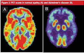 MedRead Dementia Lab Screening