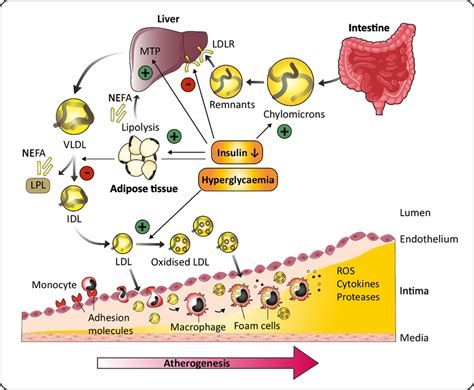 Atherogenic Lipoproteins In Individuals With Type 1 Diabetes With Poor Download Scientific
