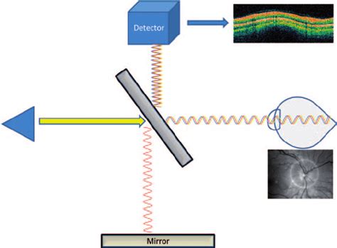 Diagram Of Optical Coherence Tomography Download Scientific Diagram