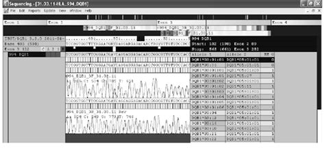 2 Analysis Of The Row Data In Sequencing Based Typing Of Hla Dqb1 Download Scientific Diagram