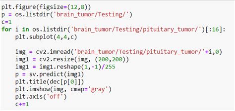 github akd6203 brain tumor detection in this repository i have explained the process of
