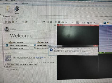 数据导入失败,将练习001拖入,显示下面图片,最后是空的 问题求助 3dslicer中文论坛 数据导入失败,将练习001拖入,显示下面图片,最后是空的 问题求助 3dslicer中文论坛