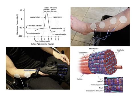 Neuromuscular Electrical Stimulation For Post Stroke Motor Recovery A