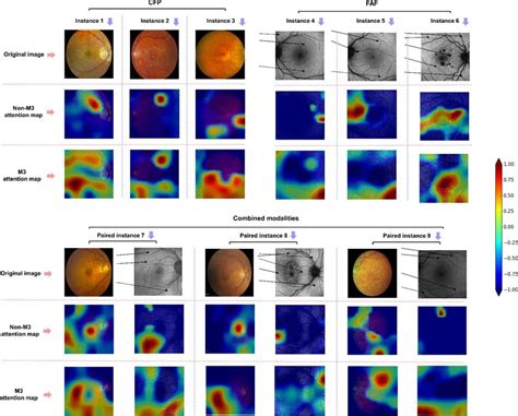 Deep Learning Attention Maps Overlaid On Representative Image Examples