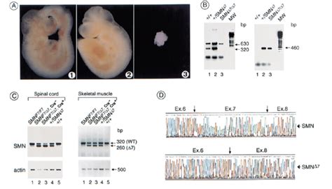 Deletion Of Smn Exon 7 In All Cell Types A Nine Day Post Coitum
