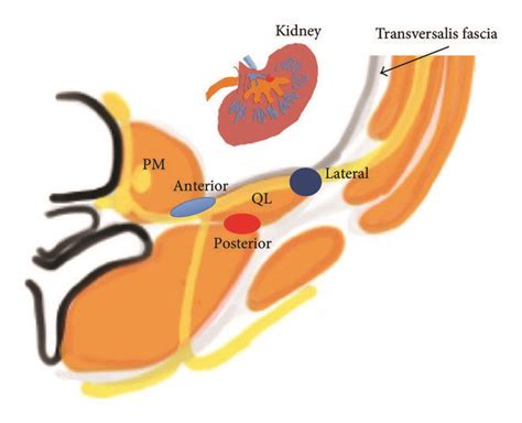 Anatomic View Of Quadratus Lumborum Ql Block Anterior Lateral And Download Scientific