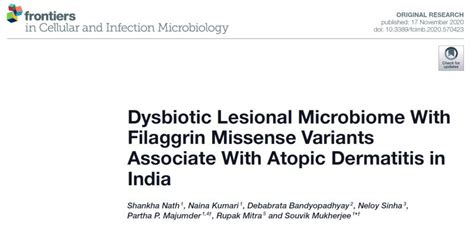 Souvik Mukherjee On Linkedin Atopic Dermatitis Has Been Associated