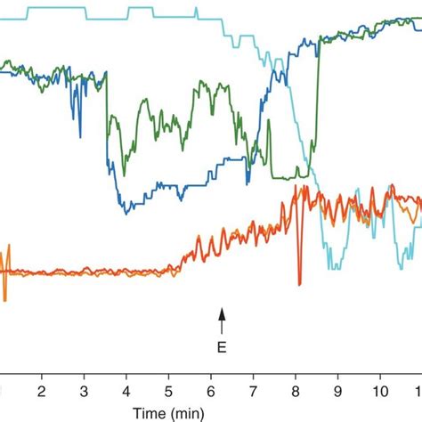 Pdf Response Of Bispectral Index To Neuromuscular Block In Awake Volunteers