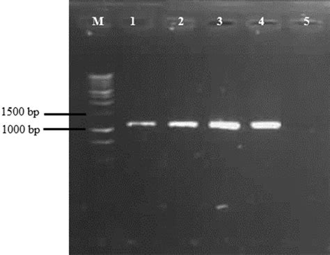 Representative Amplification Of 16s Rrna Gene For The Detection Of Download Scientific Diagram