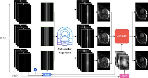 Figure 2 From End To End Adaptive Dynamic Subsampling And Reconstruction For Cardiac Mri