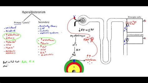 Conns Syndrome Primary Hyperaldosteronism Made Easy Youtube