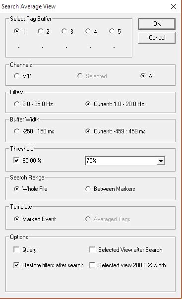 Pipeline For Simultaneous Eeg Fmri Recording Besa® Wiki