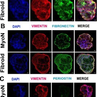 The Production Of Extracellular Matrix Proteins In Human Normal Download Scientific Diagram