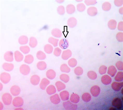 ЗООНОЗЫН Зоонозын Өвчин Судлалын Үндэсний Төв ЗӨСҮТ