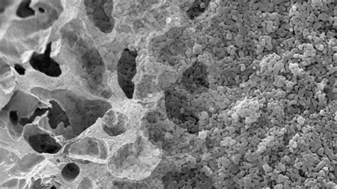 Bone Substitutes Advanced Medical Solutions