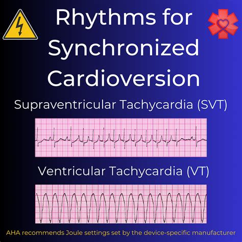 Acls Bradycardia Algorithm Review
