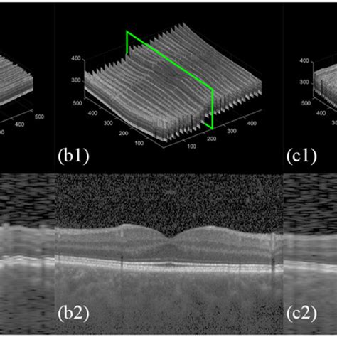 A 3d Oct Volume With Axial Motion Artifacts Indicated With Red Download Scientific Diagram