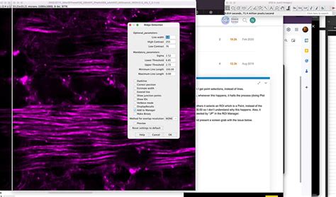 Ridge Detection Point Selection Problem Image Analysis Imagesc Forum