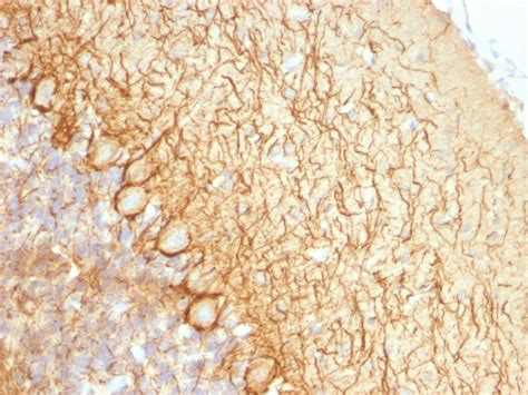 Neurofilament Nf L Neuronal Marker Antibody Clone Nr 4 Gene Id 4747