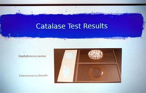 Catalase Test Results Staphylococcus Aureus Enterococcus Faecalis