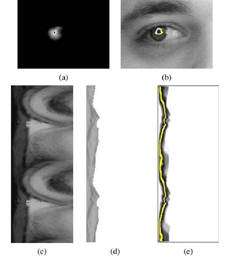 A Generalized Distance Function For Pupil Center Detection And Download Scientific Diagram