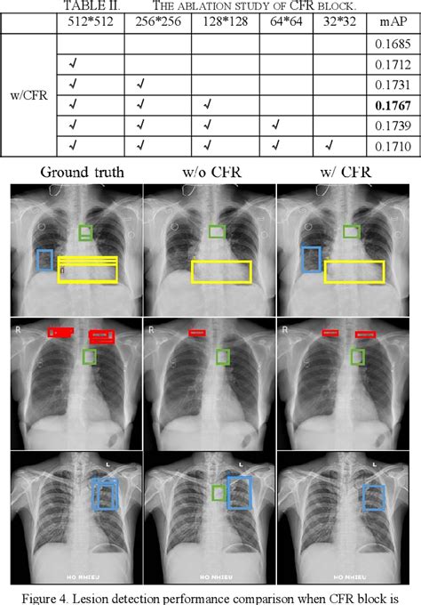 Figure 1 From A Coarse Feature Reuse Deep Neural Network For Cxr Lesion