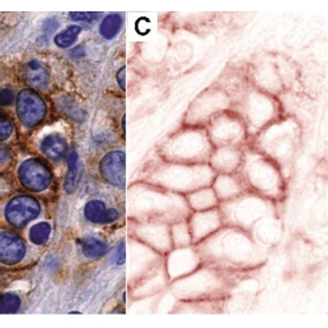 Example Of Spectral Unmixing For Enzymatic Immunohistochemistry A