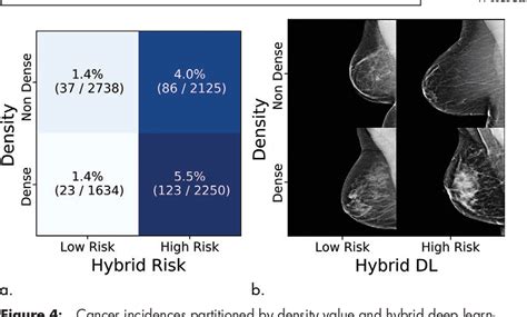 Figure 4 From A Deep Learning Mammography Based Model For Improved Breast Cancer Risk Prediction