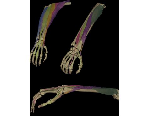 Forearm Extensor Muscles — Printable Worksheet