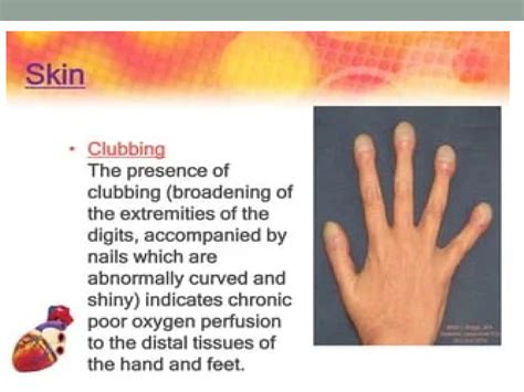 Cardiovascular Assessment For Nursespptx