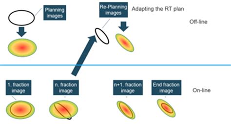 Wp4 Adaptive Radiation Therapy
