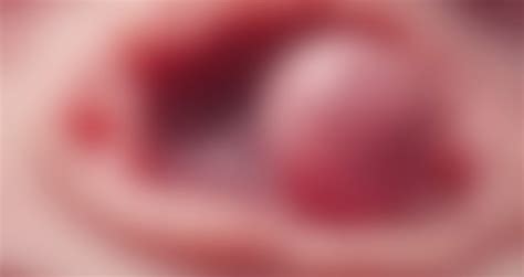 What Does A Vaginal Tear Look Like Symptoms You Shouldnt Ignore