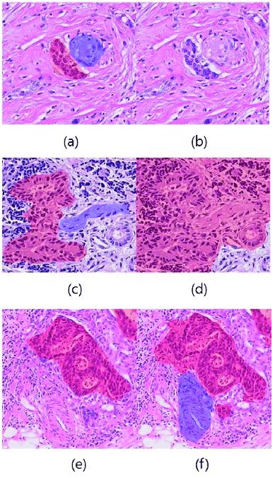 Examples Of Misclassification With Ground Truths A C E And The Download Scientific Diagram