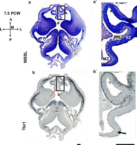 Development Of The Medial Interhemispheric Cortex Revealed By Nissl Download Scientific Diagram