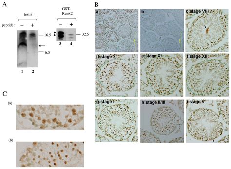 A Variant Of Runx2 That Differs From The Bone Isoform In Its Splicing