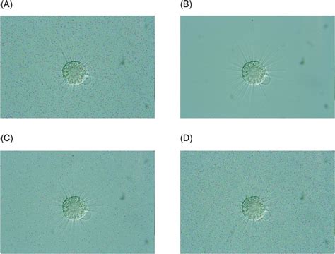 An Example Of Different Noisy Em Images Using Emds 5 Images