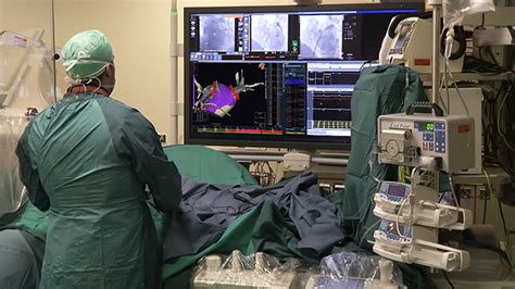 About The Ensite Precision Cardiac Mapping System Abbott