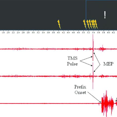 Sigmoid Function Parameters Download Table