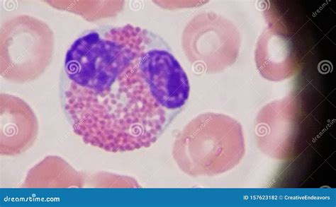 外周血涂片嗜酸粒细胞和红细胞 库存照片 图片 包括有 科学 完全 计数 电池 正常 显微镜 157623182