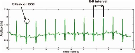 R R Interval Calculations From ECG Unless CC License In Place See Download Scientific