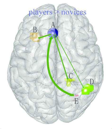 Enhanced Functional Connections Between Left Medial Frontal Cortex Download Scientific