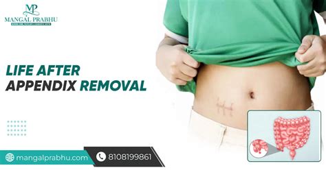 After Appendix Removal Laparoscopic Appendectomy Appendix Removal