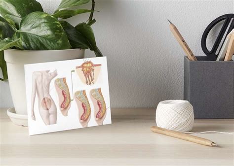 Pilonidal Cyst 10 Causes Of Pilonidal Cyst