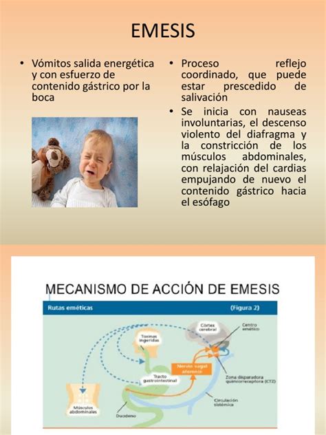 Síndrome Emético Y Reflujo Gastroesofágico Antto Pdf Vómitos