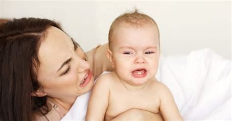 Cleidocranial Dysplasia Gejala Penyebab Hingga Penanganan