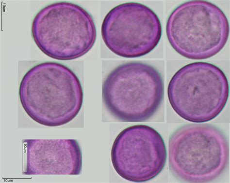 Datei Vitis Vinifera Inaperturate  Pollen Wiki